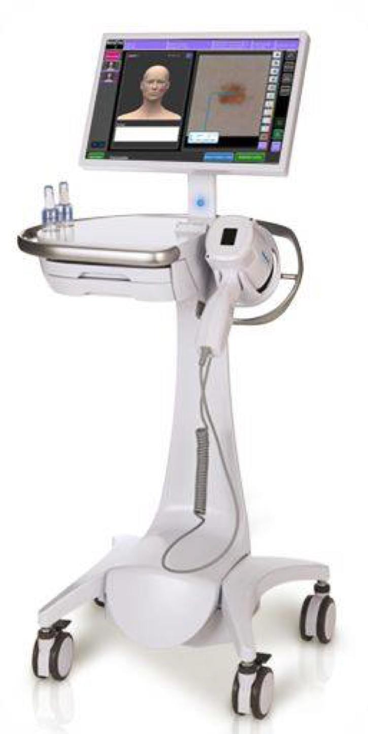 Melafind® Melanoma Detection Cancerquest